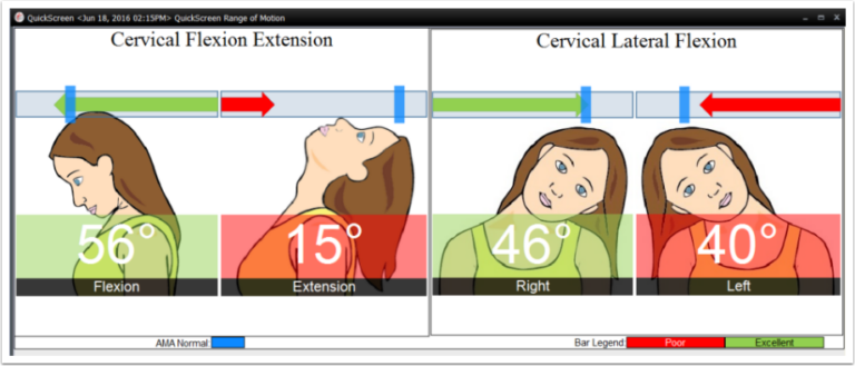 Software | MyoVision