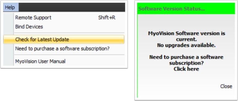 Software | MyoVision