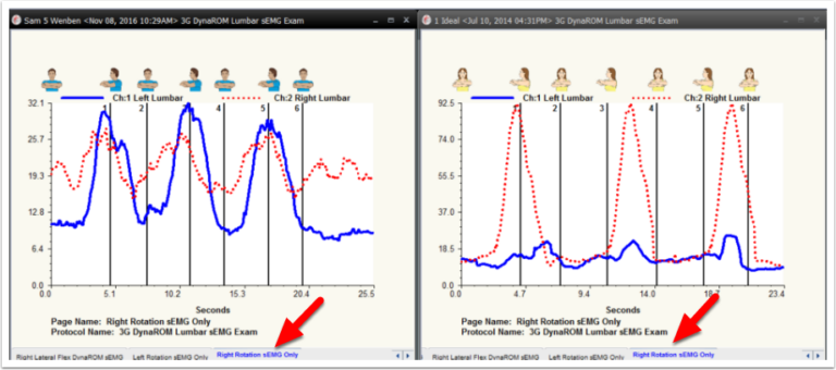 Software | MyoVision