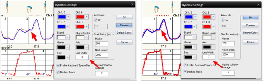 Software | MyoVision