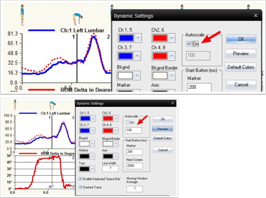 Software | MyoVision