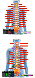 Patients | MyoVision
