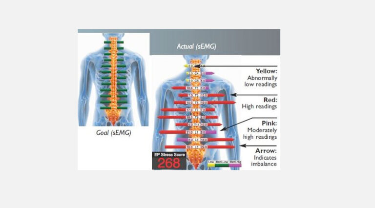 Patients | MyoVision
