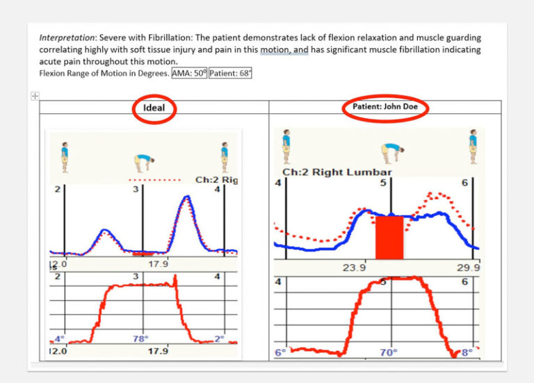 Software | MyoVision