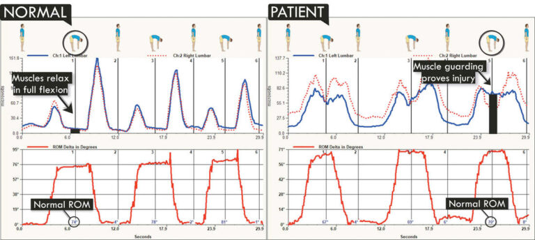 Software | MyoVision