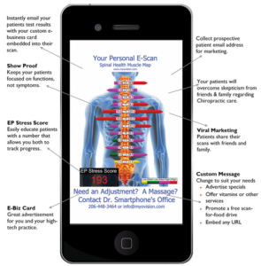 ScanVision | MyoVision